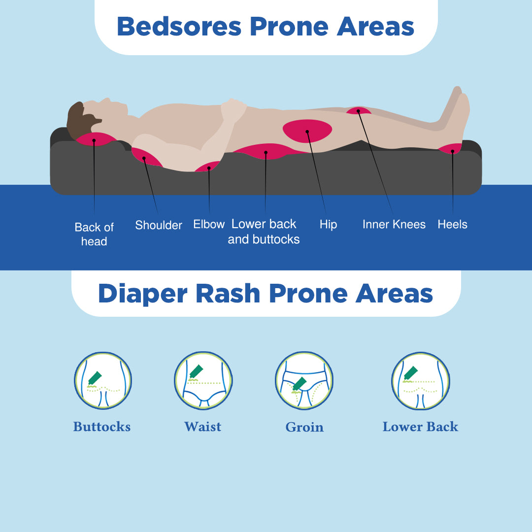 Soreze Spray - India's No.1 Bedsore and Adult Diaper Rash Prevention Spray